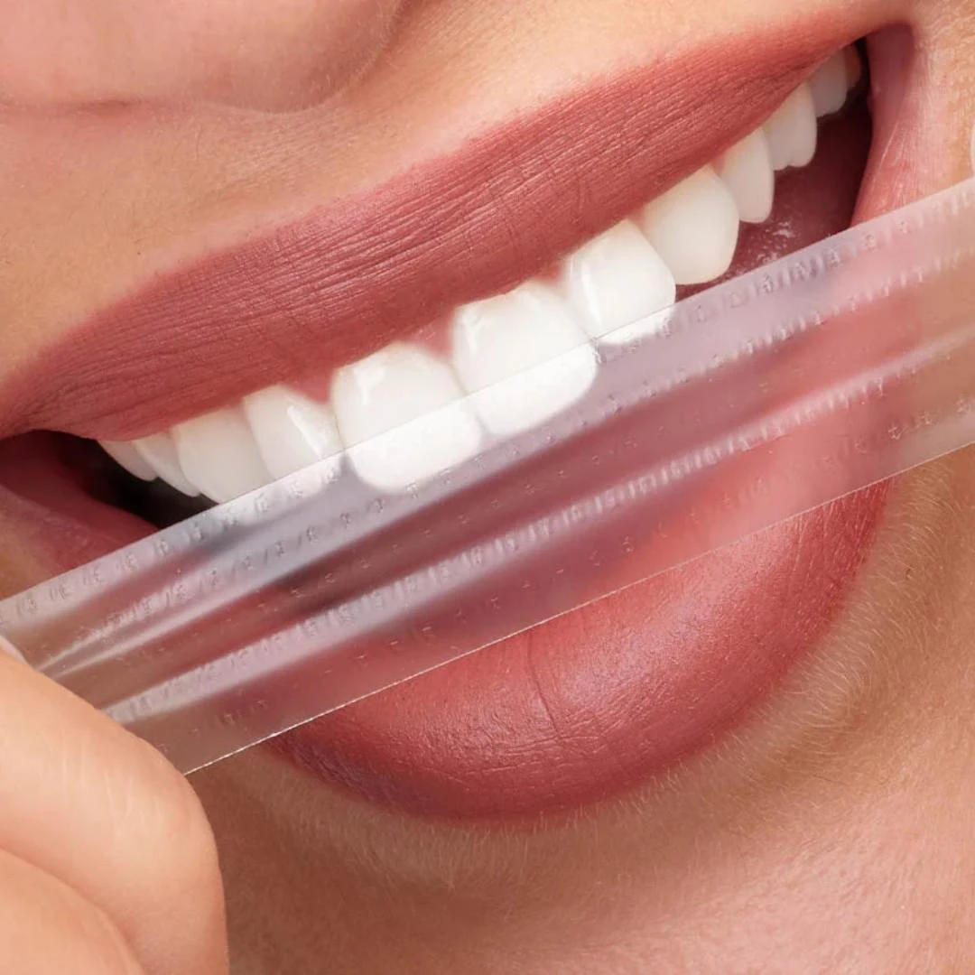 HelloSmile PAP+ Trakice za Izbeljivanje Zuba 14 Komada, | eApoteka