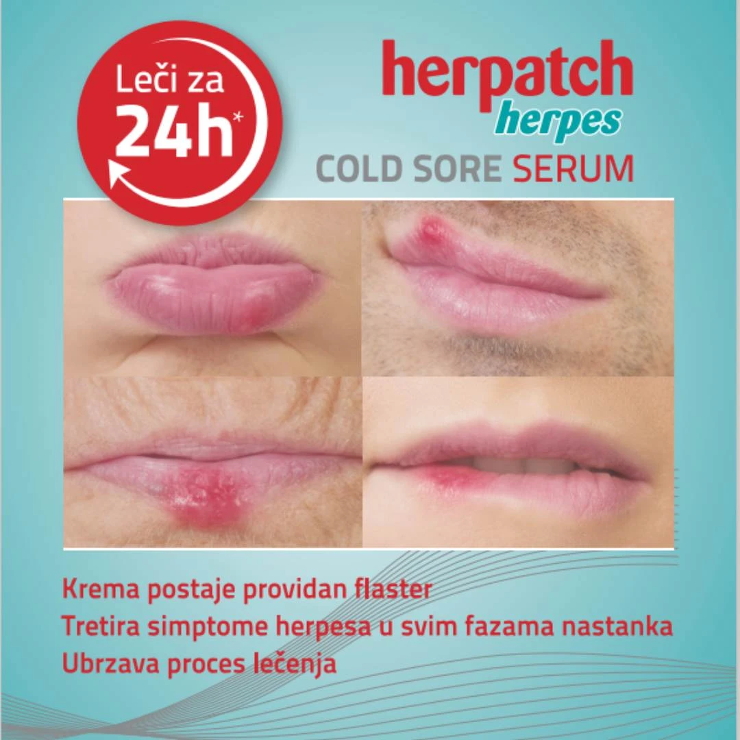 HERPATCH Cold Sore Serum za Herpes 5 mL, | eApoteka