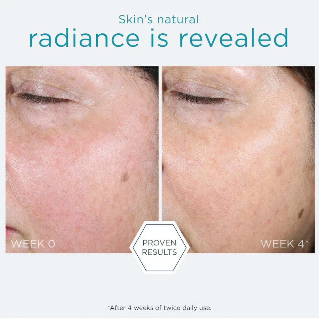 NEOSTRATA® RESTORE PHA Renewal Pads 60 Tupfera za Nežan Piling i ...