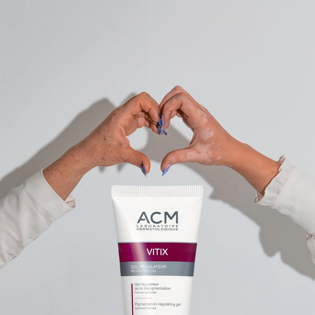 ACM VITIX Gel za Lečenje Vitiliga i Ponovnu Pigmentaciju Kože 50 mL ...
